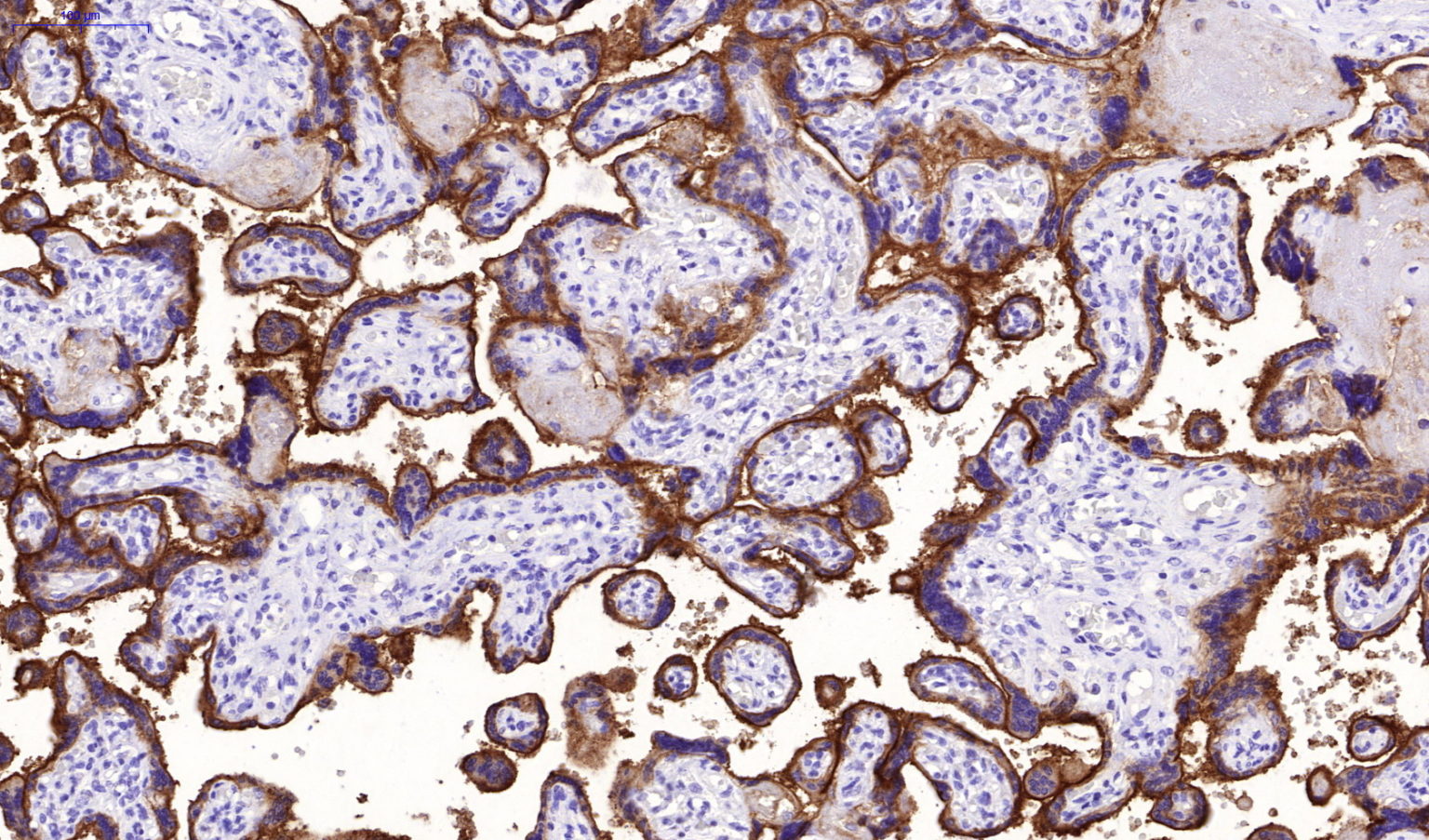 New antibody: CD274 (PD-L1) clone rPDL1/4772