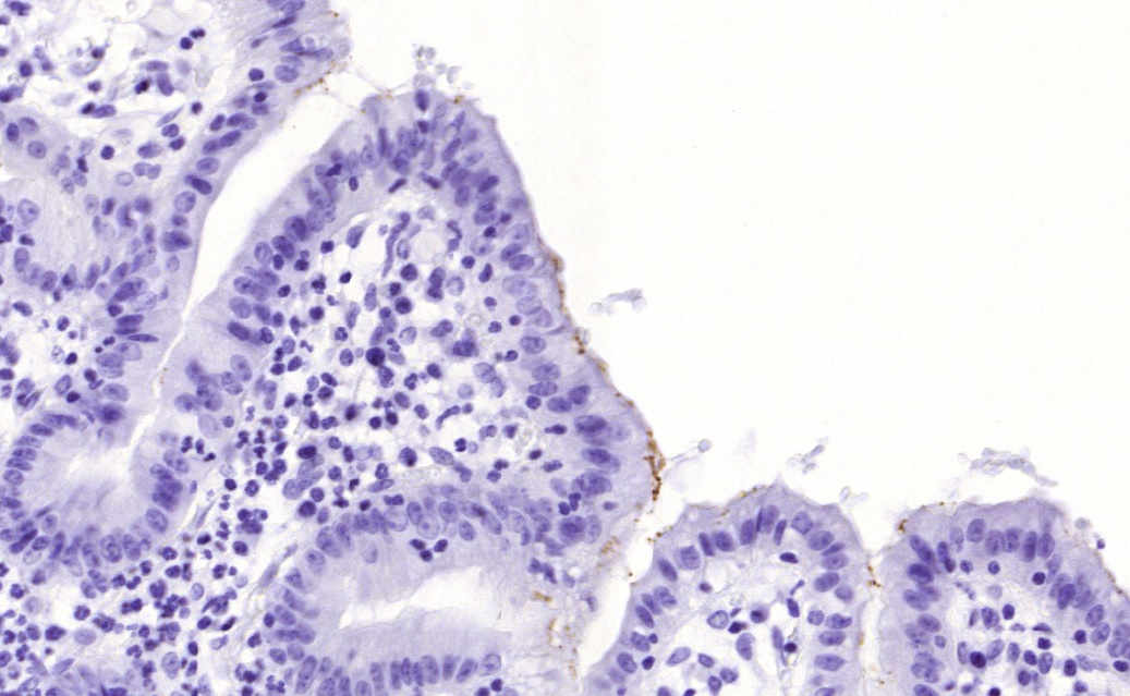 New product: Helicobacter Pylori clone HPLY/7225